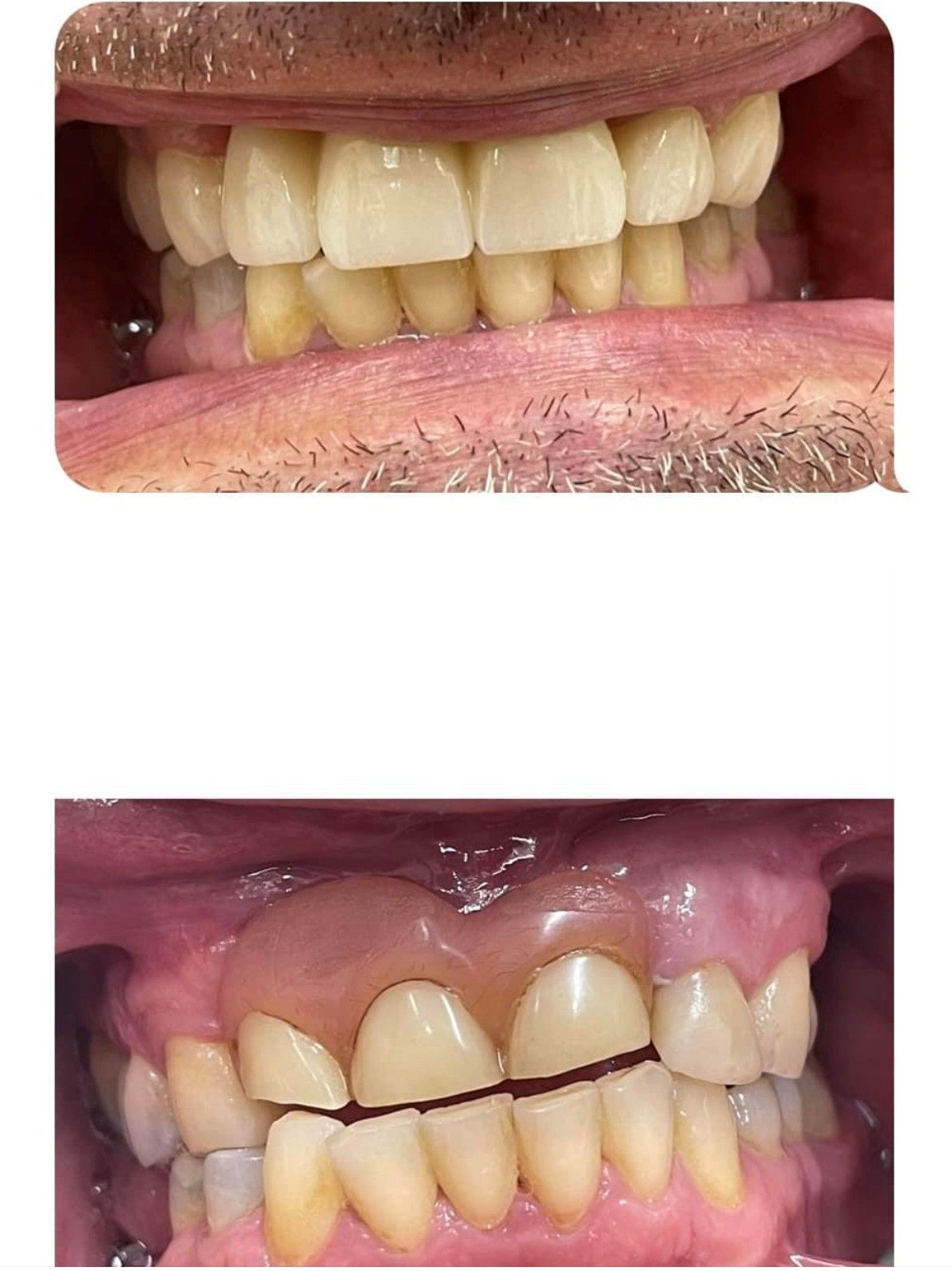 Gallery | Epping, VIC | Dento Mak Dental Surgery