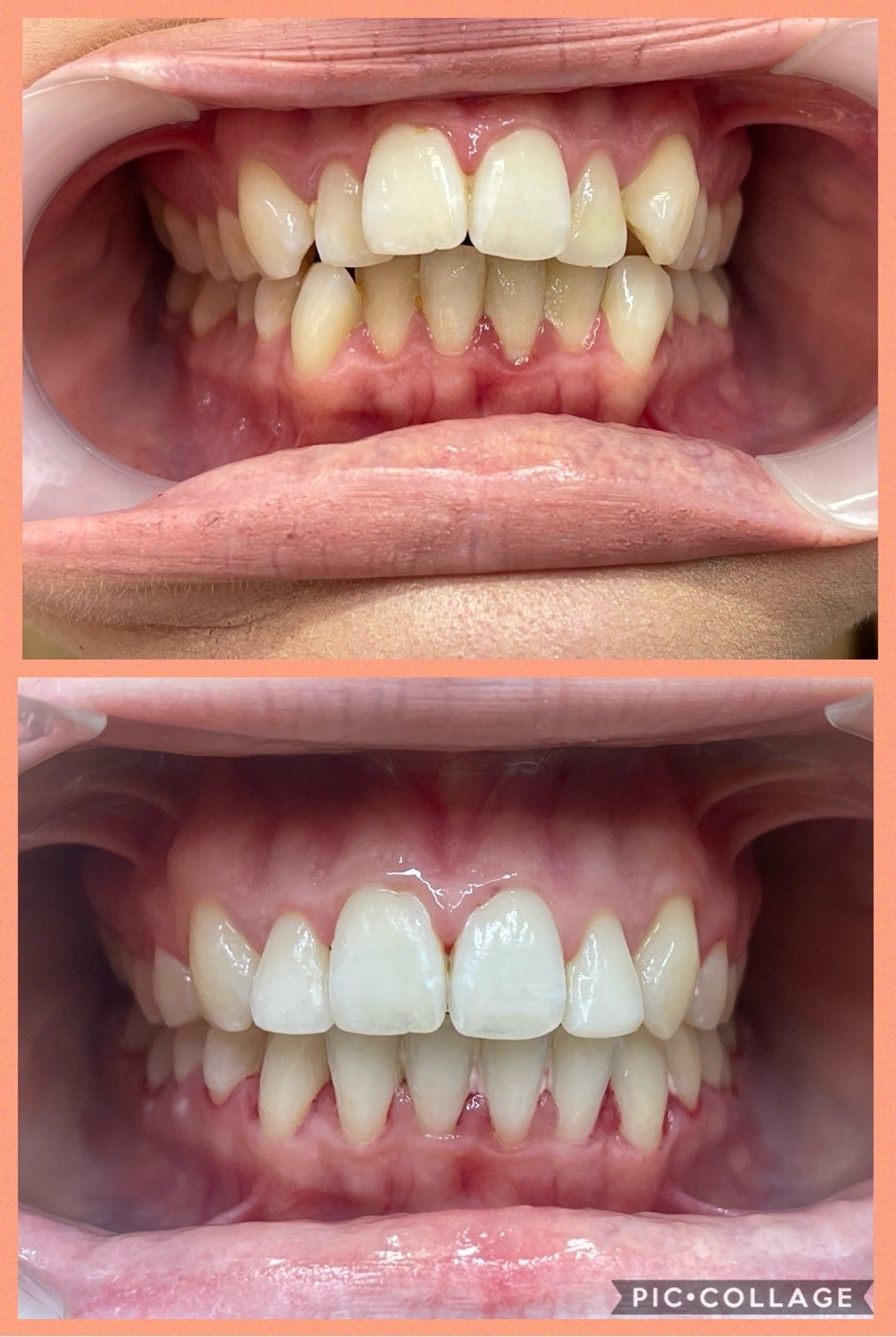 Gallery | Epping, VIC | Dento Mak Dental Surgery