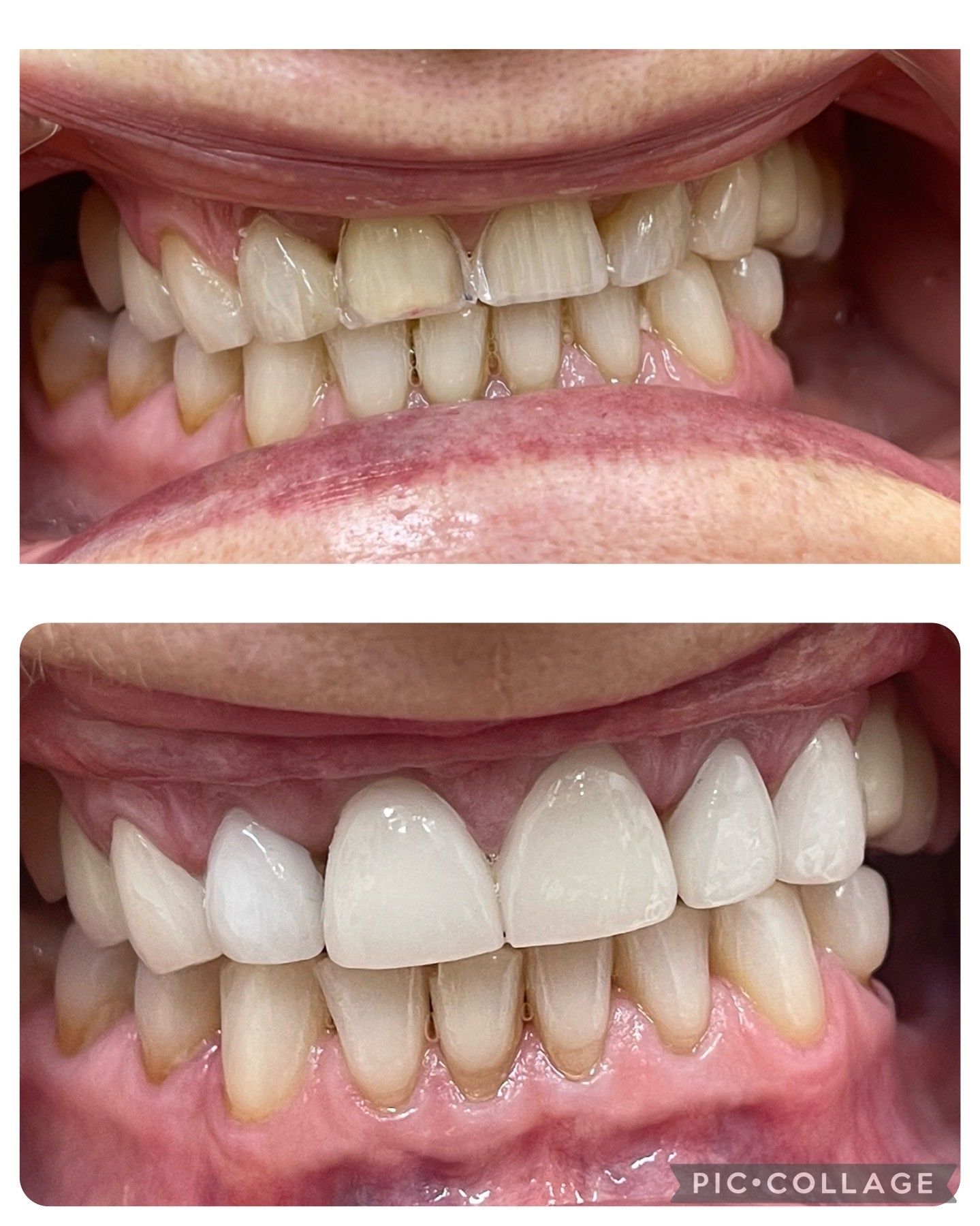 Gallery | Epping, VIC | Dento Mak Dental Surgery