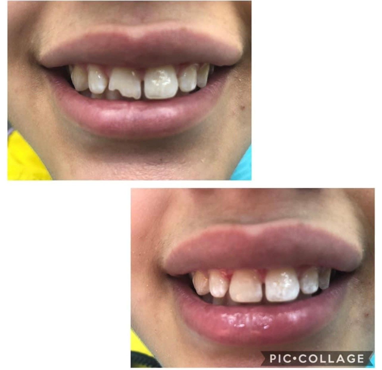 Gallery | Epping, VIC | Dento Mak Dental Surgery