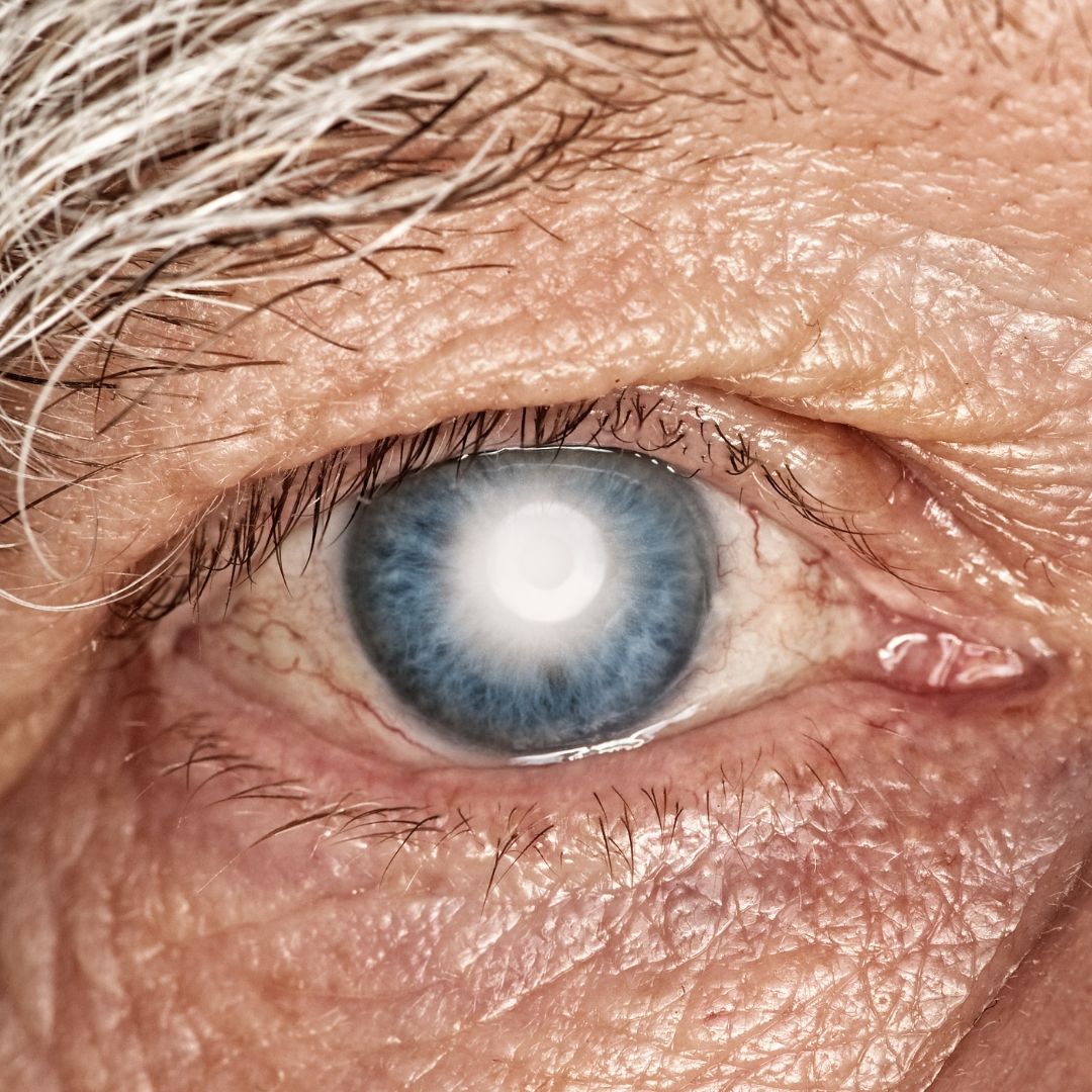 Ophthalmologist and Eye Doctor | Eye Associates of Plantation