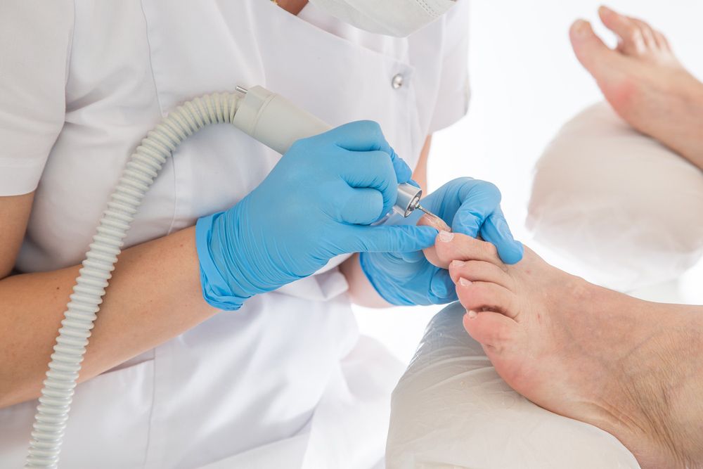 Ingrown Toenail Surgery Port Macquarie | Sandy Gugenberger Podiatrist
