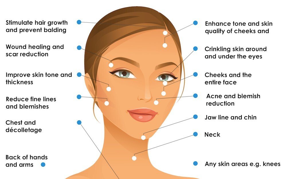 Plasma, Fibroblast Skin Tightening Treatment, Hair Loss