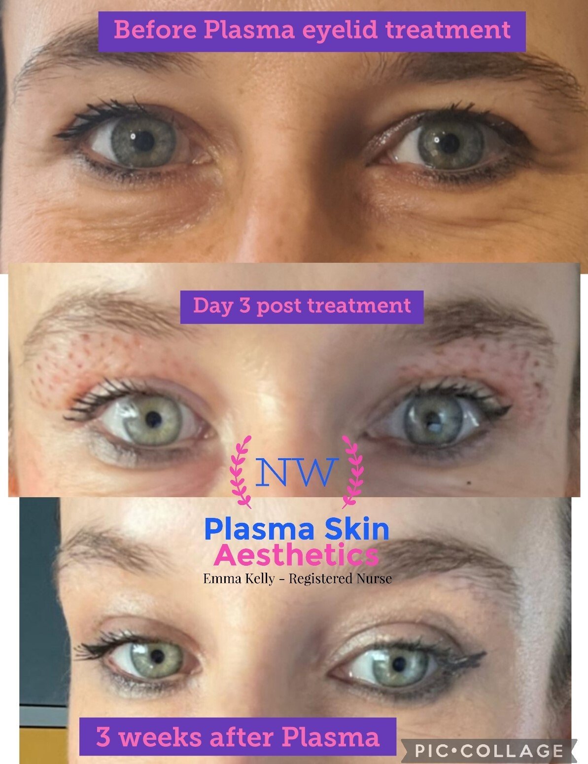 North West Plasma Skin Aesthetics