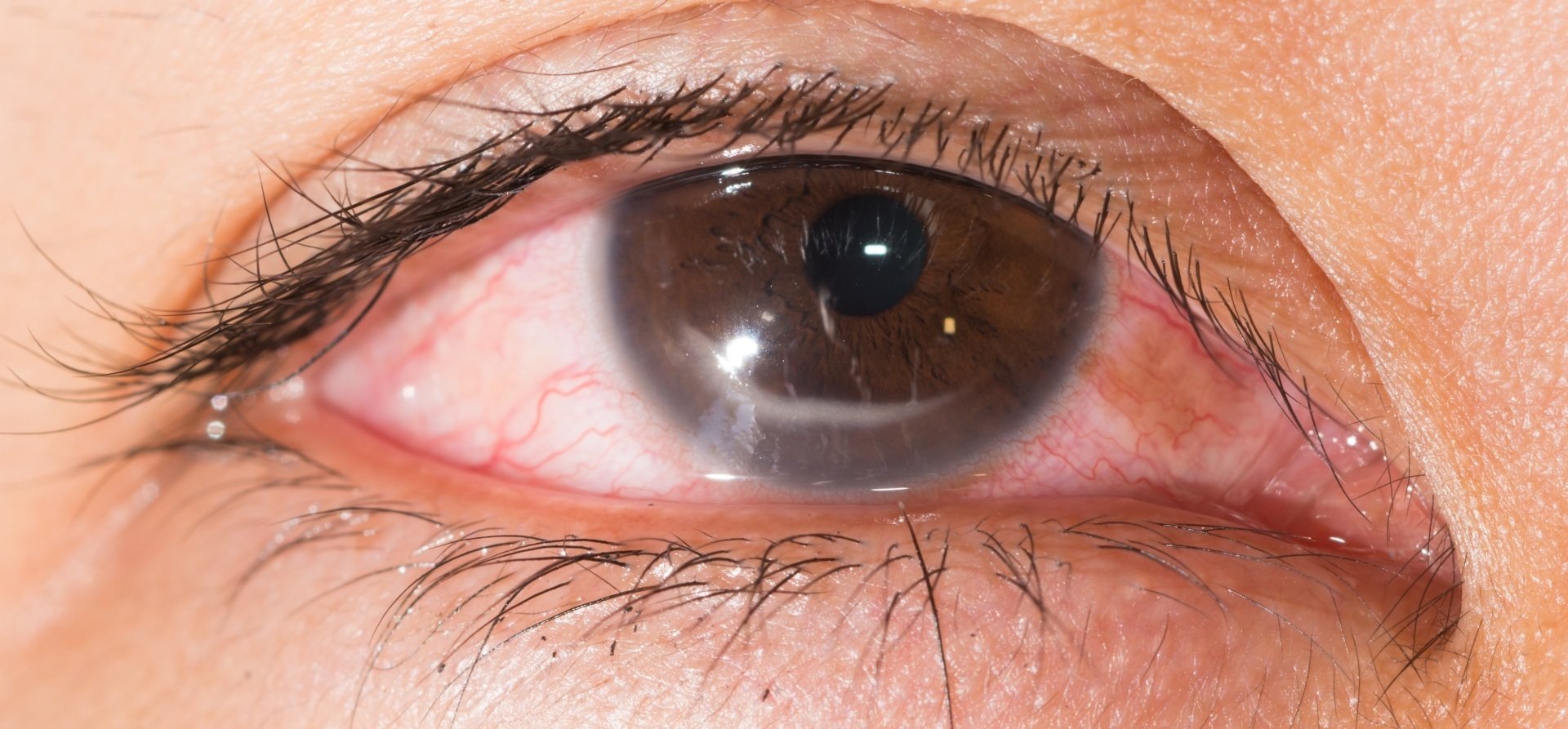 Wasatch View Eye Care | Eye Doctor in South Jordan & Lehi