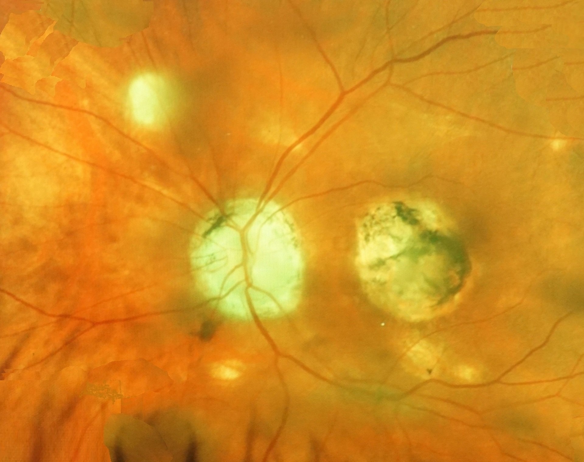 Wasatch View Eye Care | Eye Doctor in South Jordan & Lehi