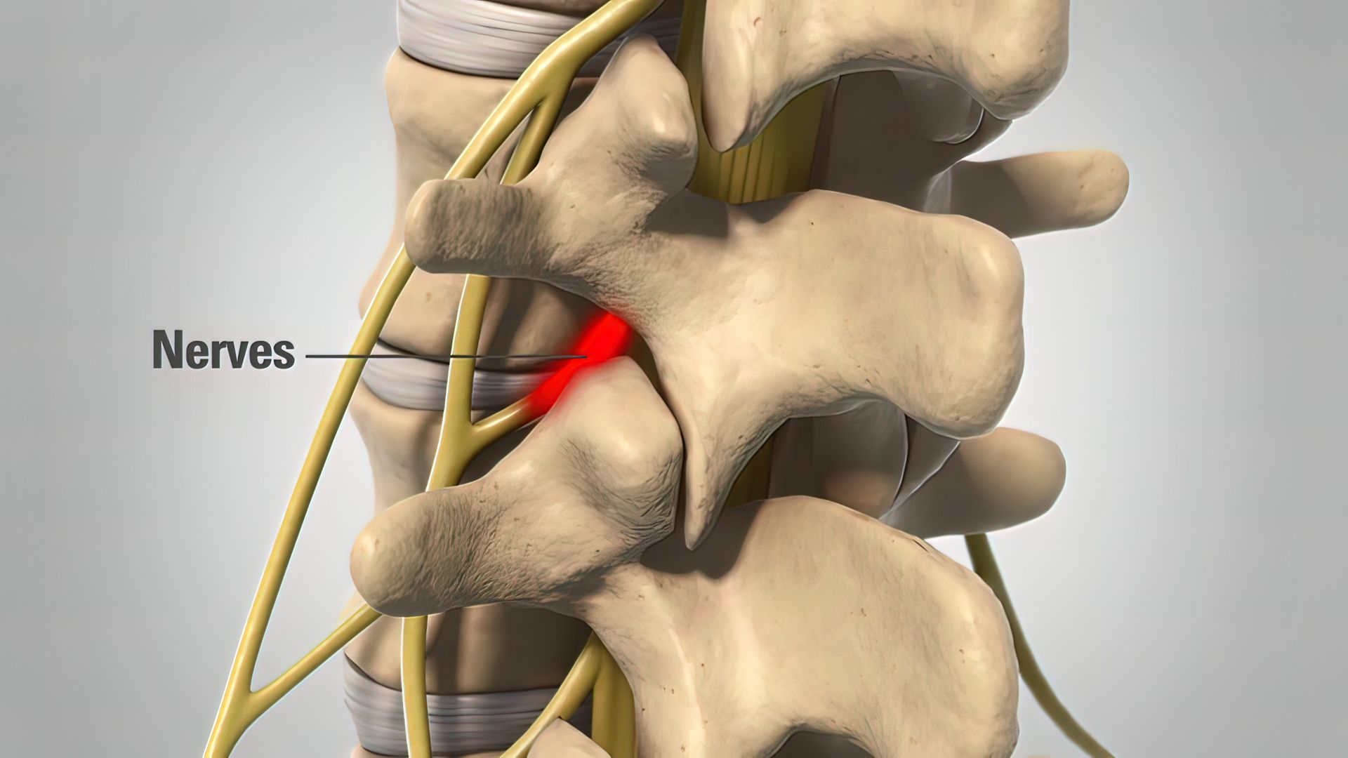 Facet Injection Service All Over Metro Atlanta, Georgia