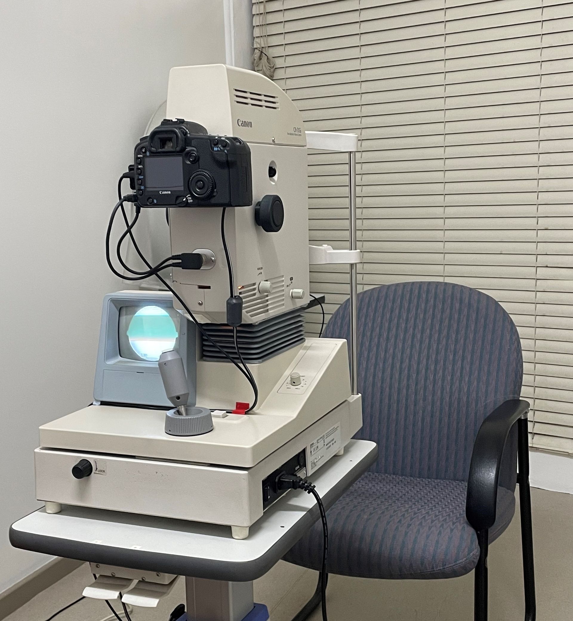 Retinal Photography in Newcastle | EyeMax EyeCare