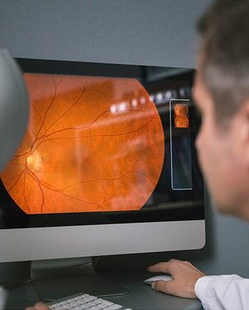 Retinal Photography in Newcastle | EyeMax EyeCare
