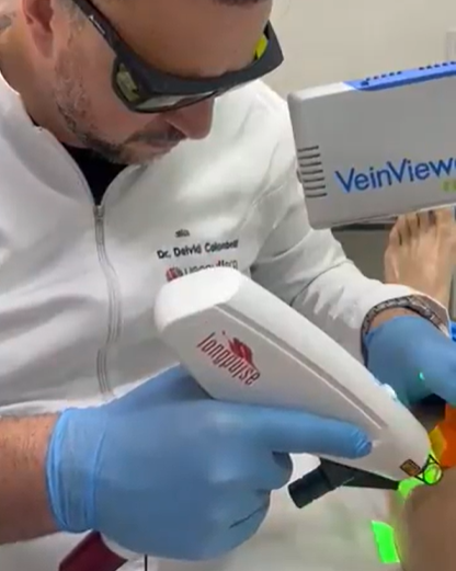 Laser transdérmico para varizes: conheça o tratamento