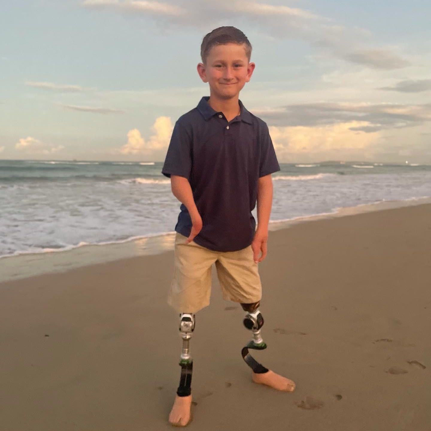 The Hearts of Camp No Limits | Meet CNL's Amazing Community