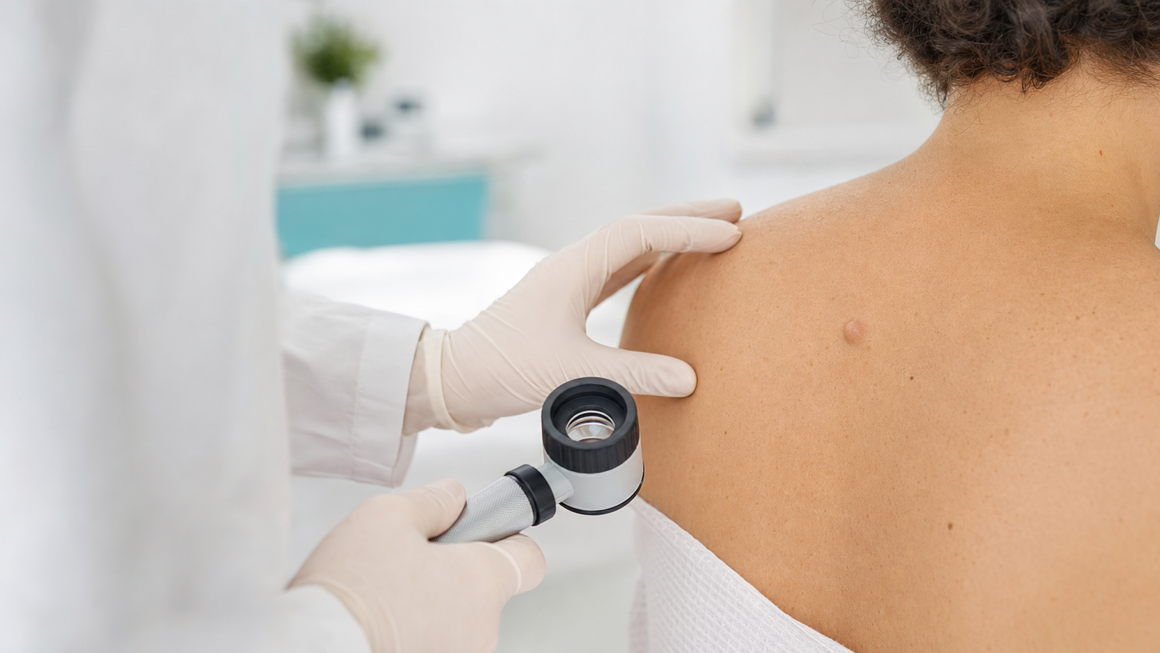 Epidermoid Cyst Removal in Kansas City