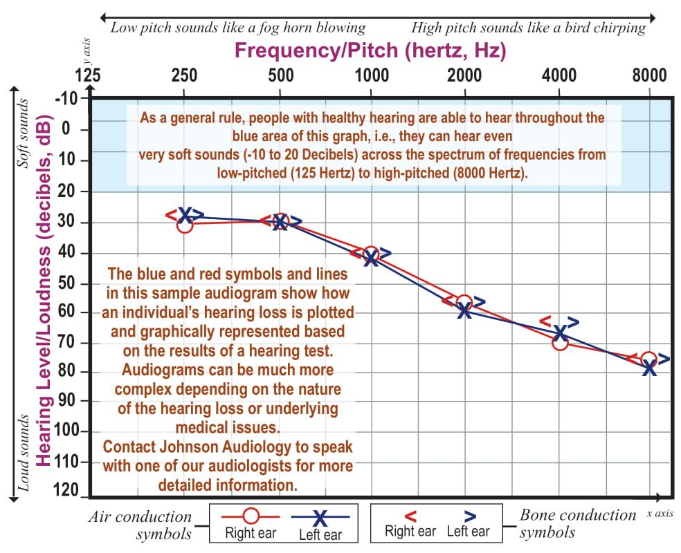 Reading An Audiogram