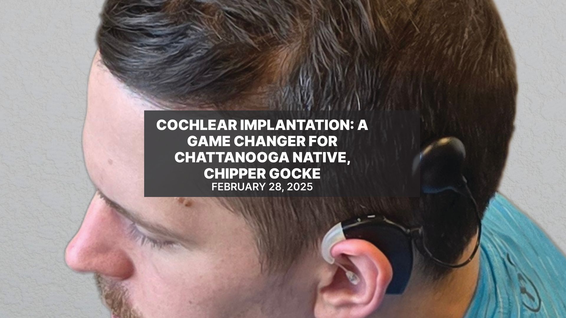 Cochlear implantation: A game changer for Chattanooga native, Chipper Gocke