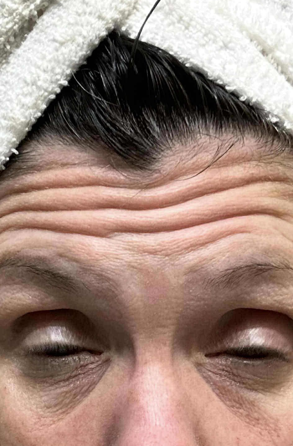 Smart Tox | Beauty Bar Med Spa