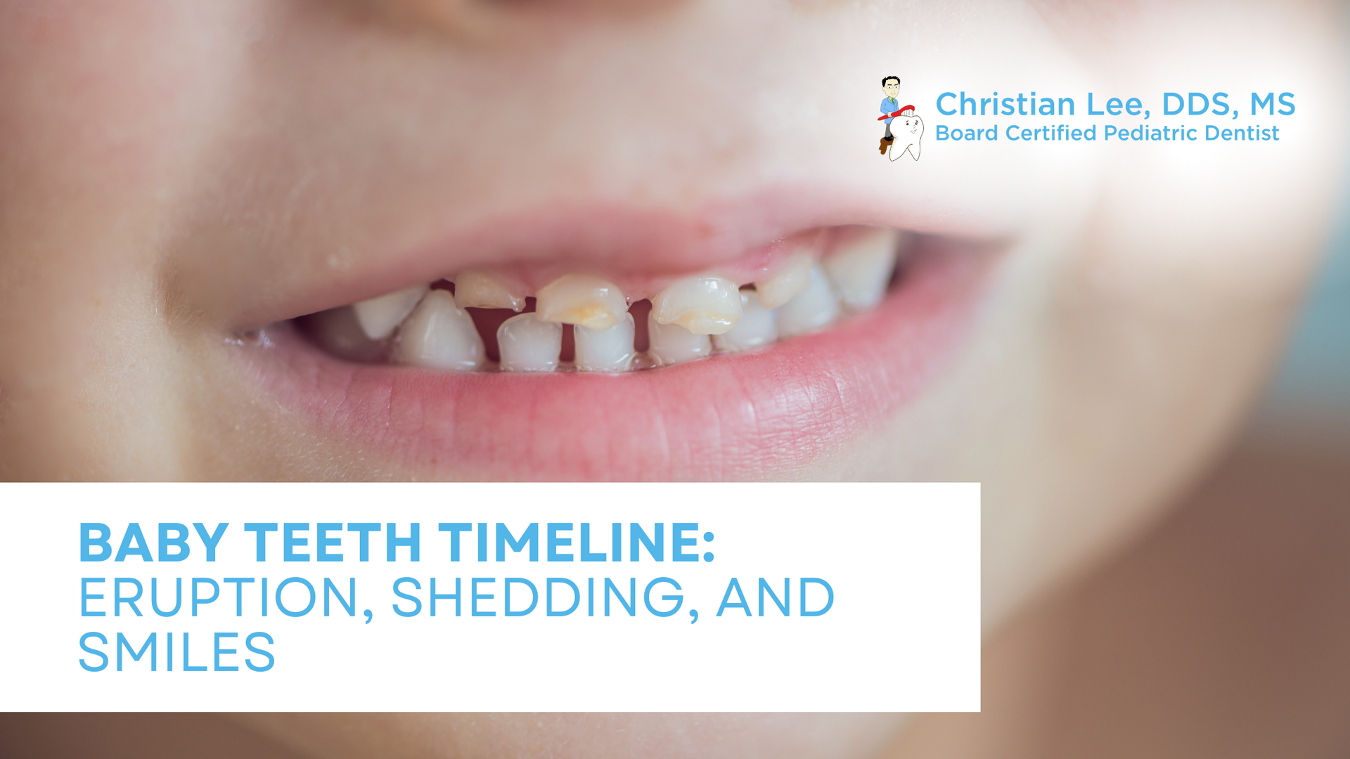 Baby Teeth Timeline: Eruption, Shedding, and Smiles