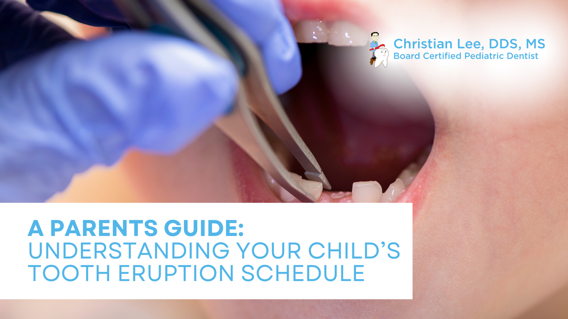 A Parents Guide: Understanding Your Child’s Tooth Eruption Schedule
