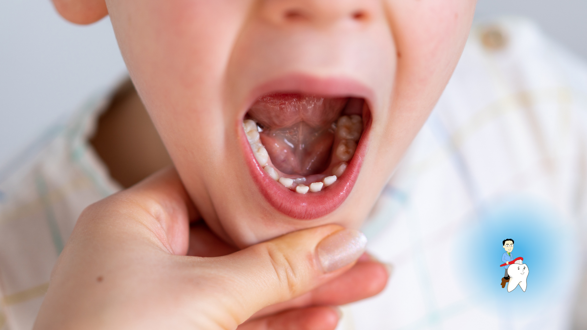 A Parents Guide: Understanding Your Child’s Tooth Eruption Schedule