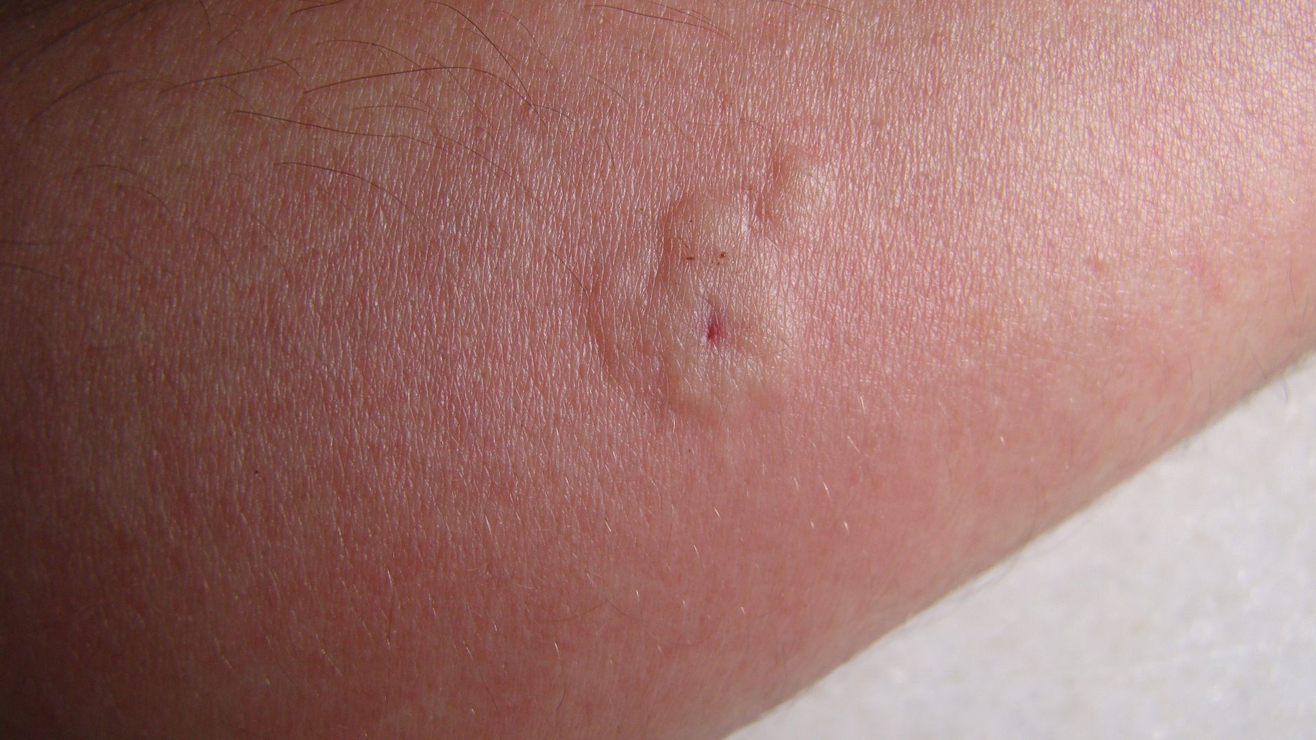 Do Bumble Bees Sting Humans? | EcoGuard Pest Management