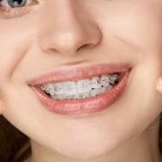 Braces from Zambrano Ortho | Braces and Invisalign | Miami