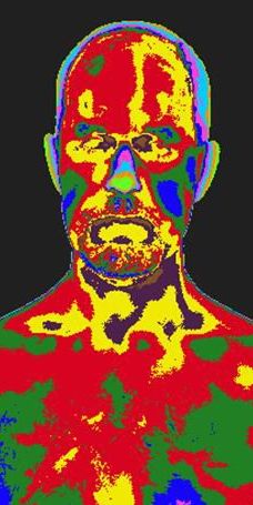 Medical Infrared Imaging | American Academy of Thermology