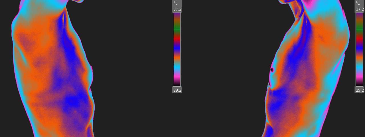 Thermology Atlas | American Academy of Thermology