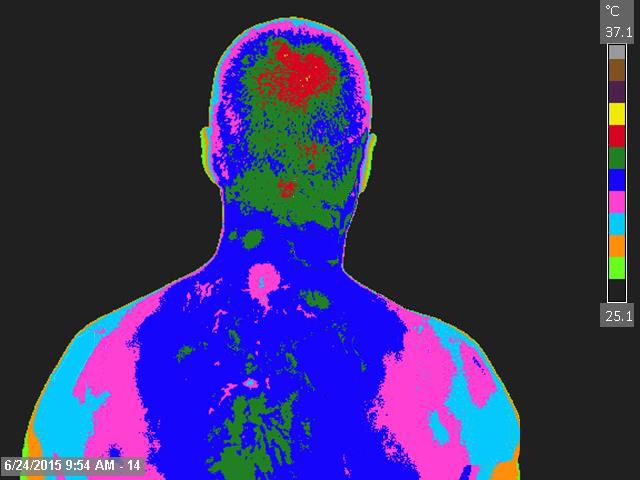 Thermology Atlas | American Academy of Thermology