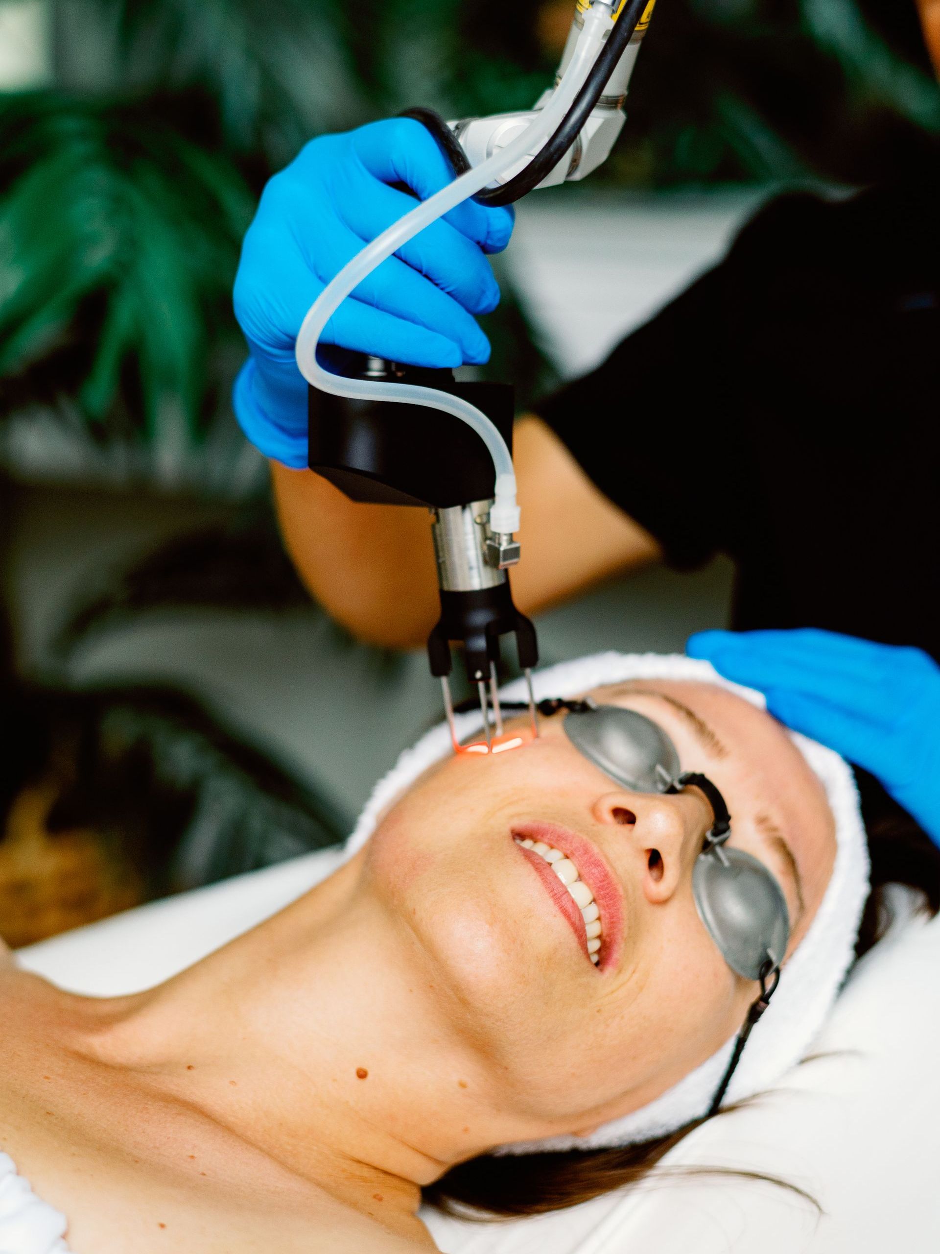 Coolpeel CO2 Laser | Waterloo, ON | Waterloo Medical Cosmetics