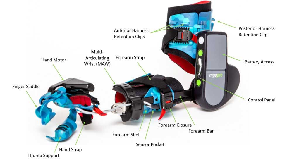 MyoPro® Orthosis | Durrett's Orthotics & Prosthetics