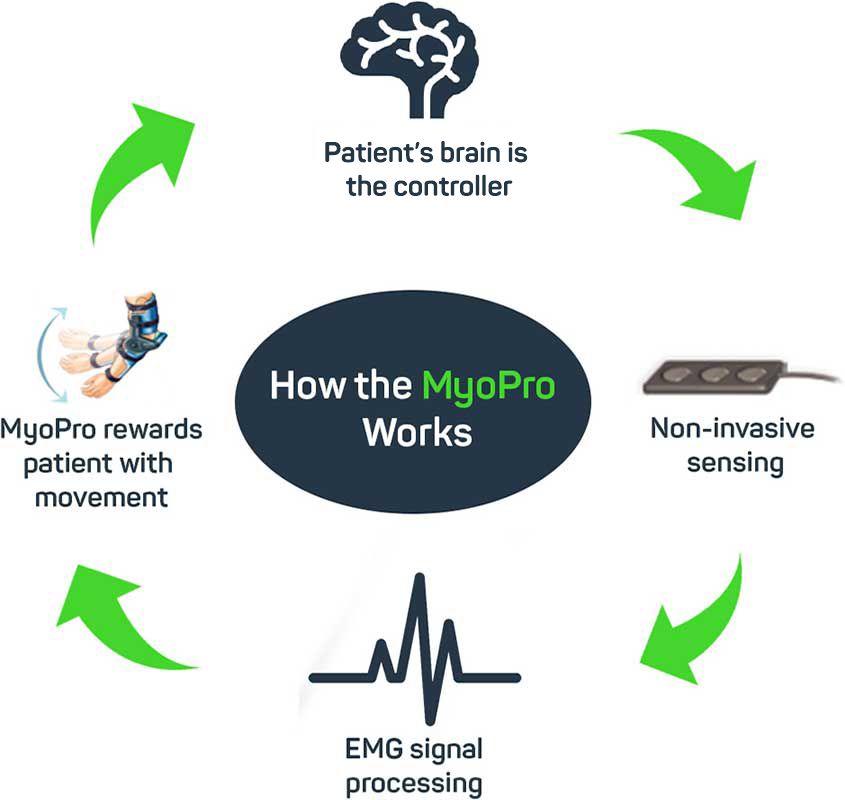 MyoPro® Orthosis | Durrett's Orthotics & Prosthetics
