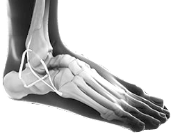Ankle Ligament Reconstruction | Dr Prasad Athreya