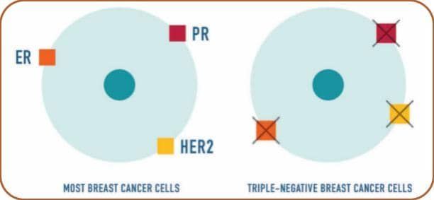 Triple Negative Breast Cancer