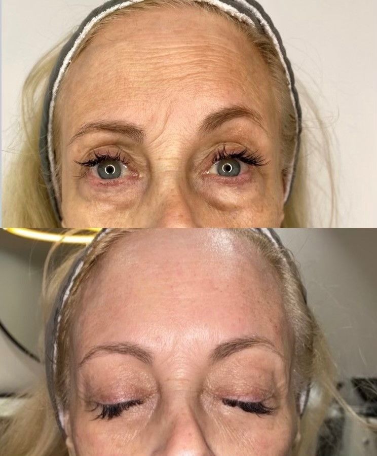 PDO AfterGlo™ Skin Booster