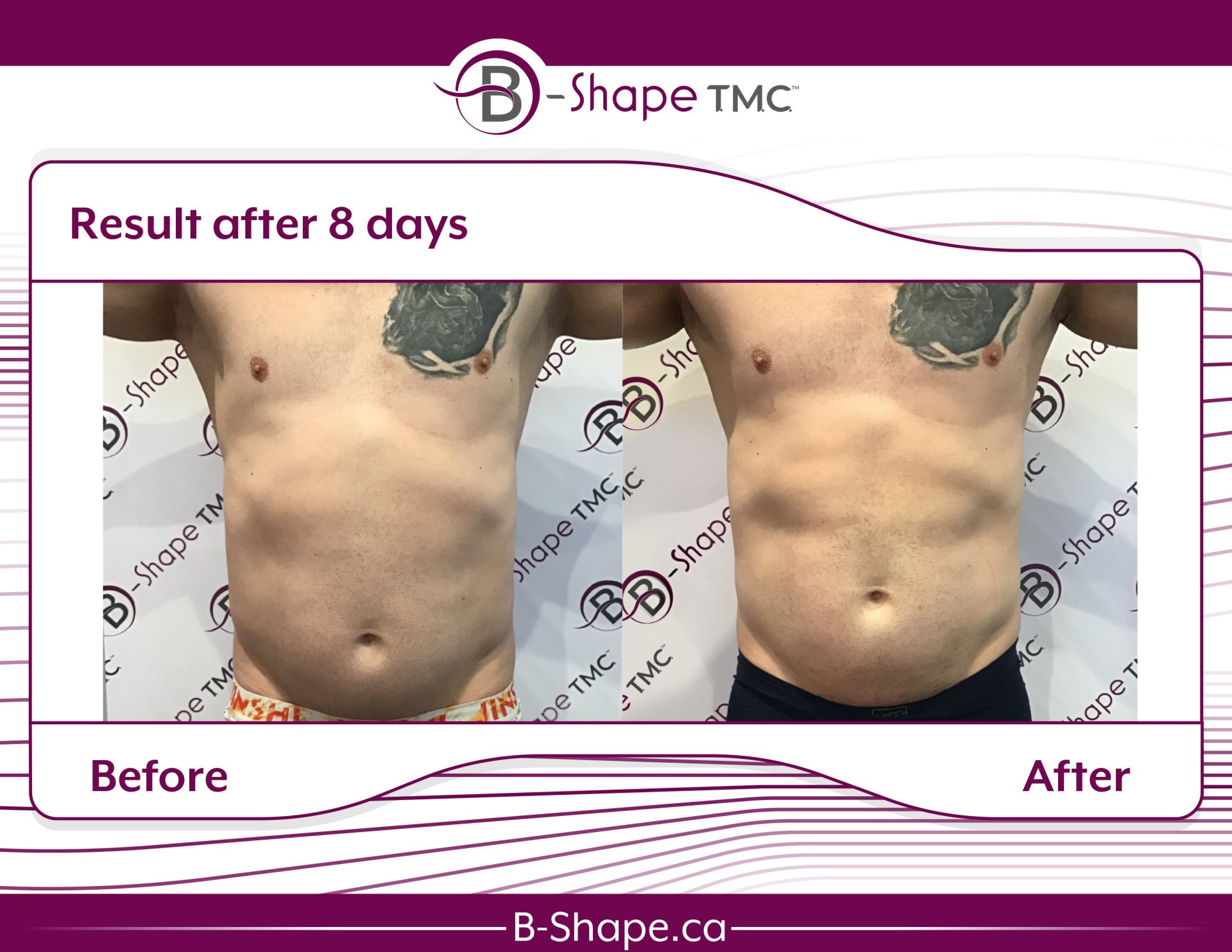 Our Treatment: What It Does | B-Shape T.M.C.