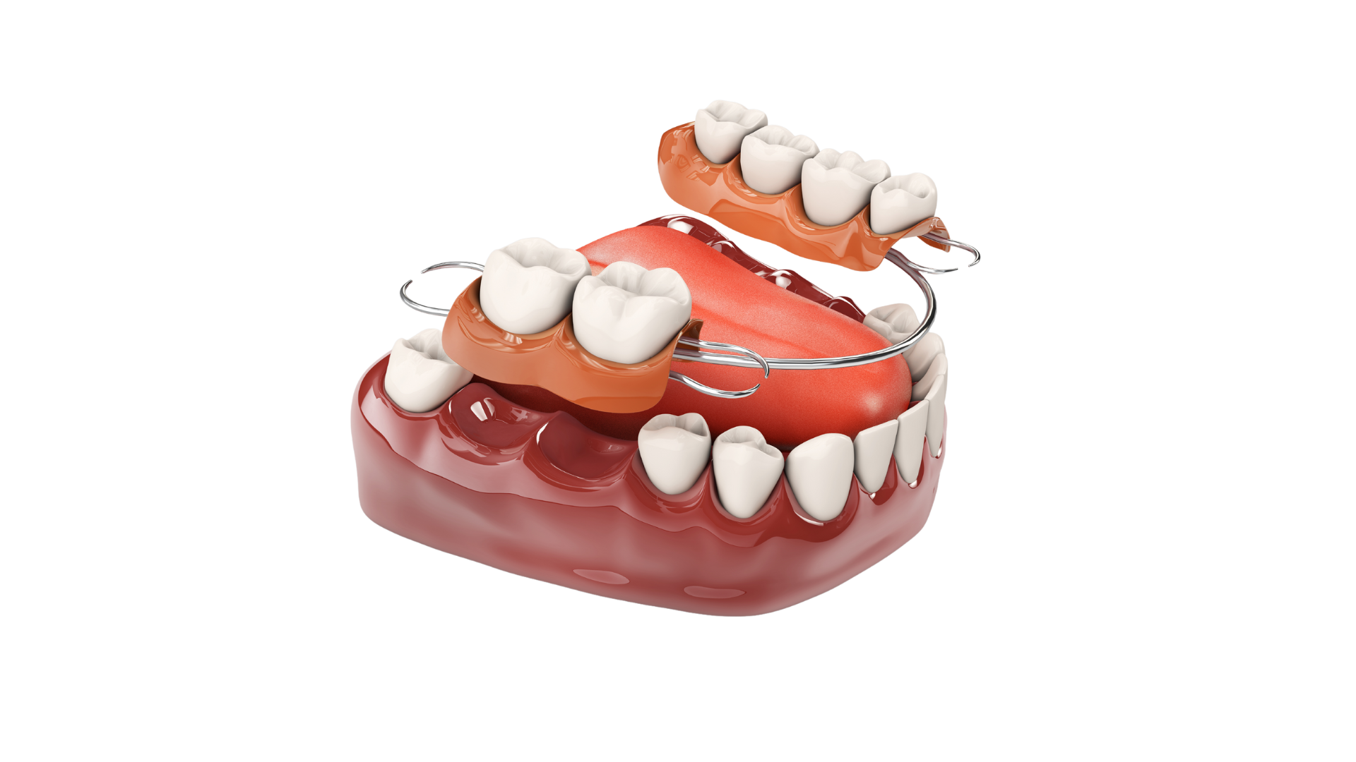 Custom Dentures and Partials in Chesapeake with Dr. Kandare