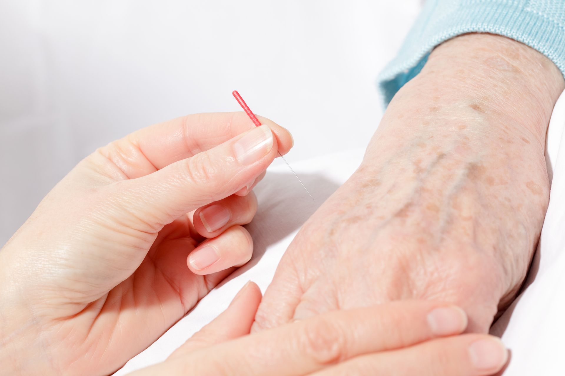 Professional Acupuncture | Glenview, IL | Healing Spring