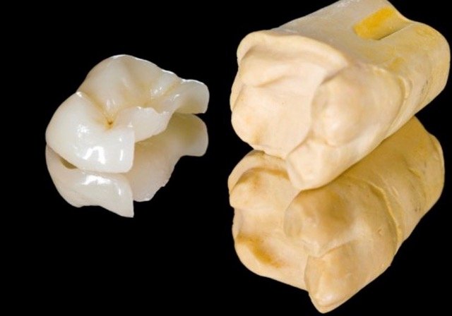 DENTISTS MEXICO RIO GRANDE DENTAL.com