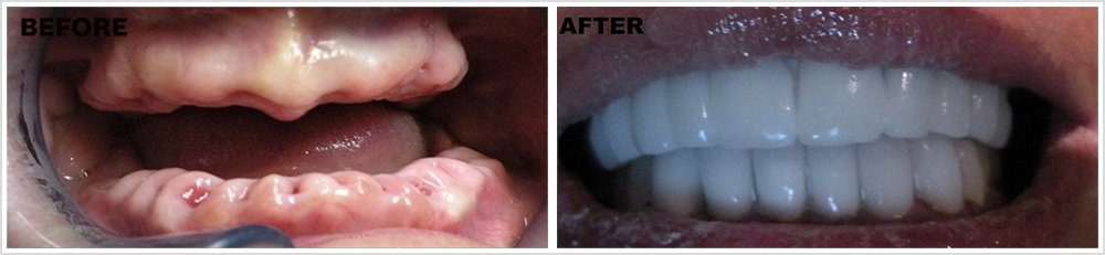 DENTISTS MEXICO RIO GRANDE DENTAL.com