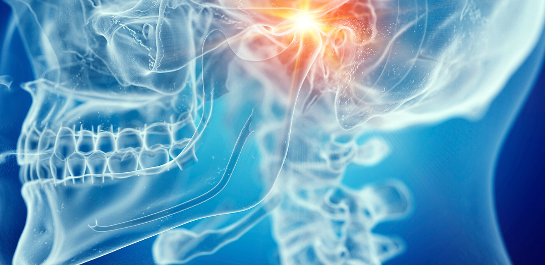 TMJD | Mckinney, TX | Bella Vida Medical Massage