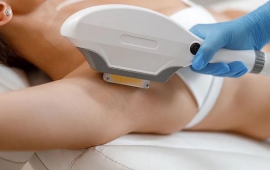 INTENSE PULSED LIGHT (IPL)