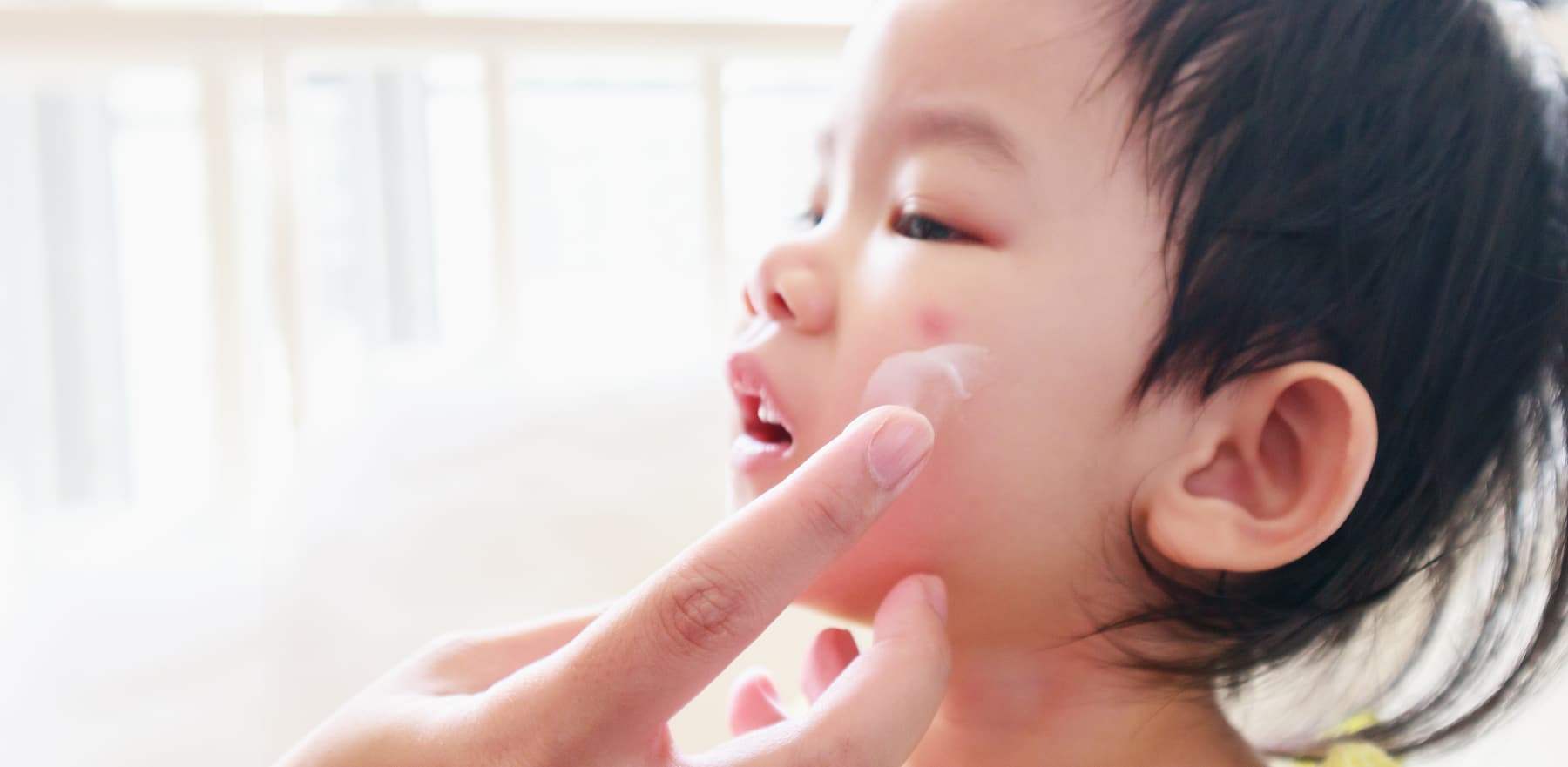 Premier Allergy Tx San Antonio Allergist And Asthma Specialist 5611