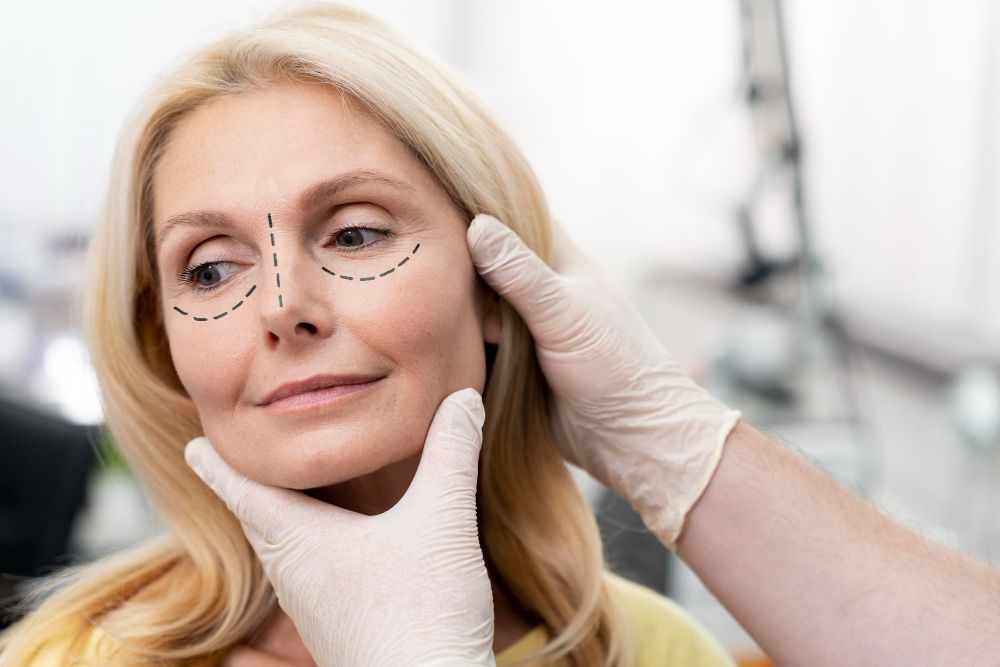 Non-Incisional Ptosis Correction (Suture Method) Cost in Korea
