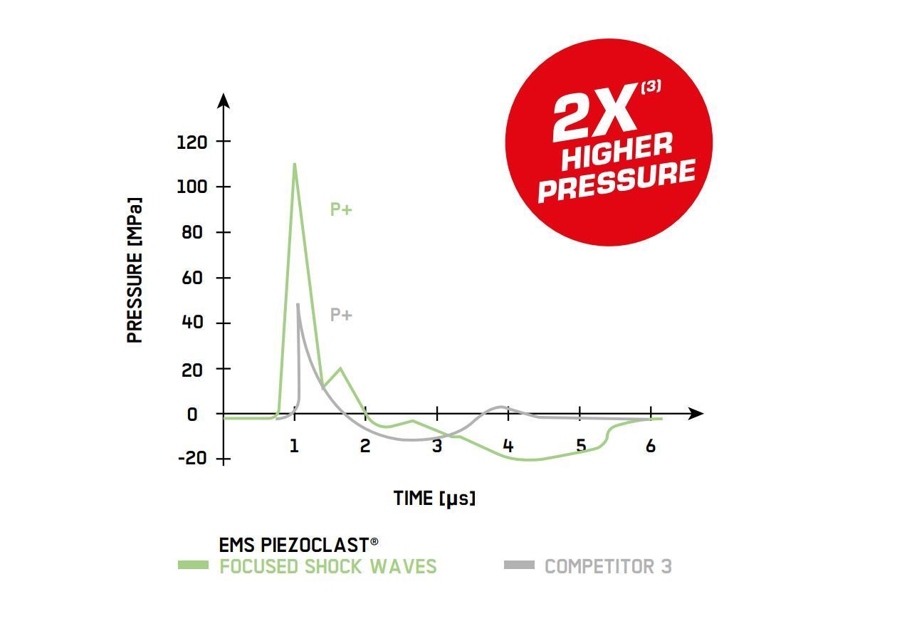 Focussed Shockwave Therapy