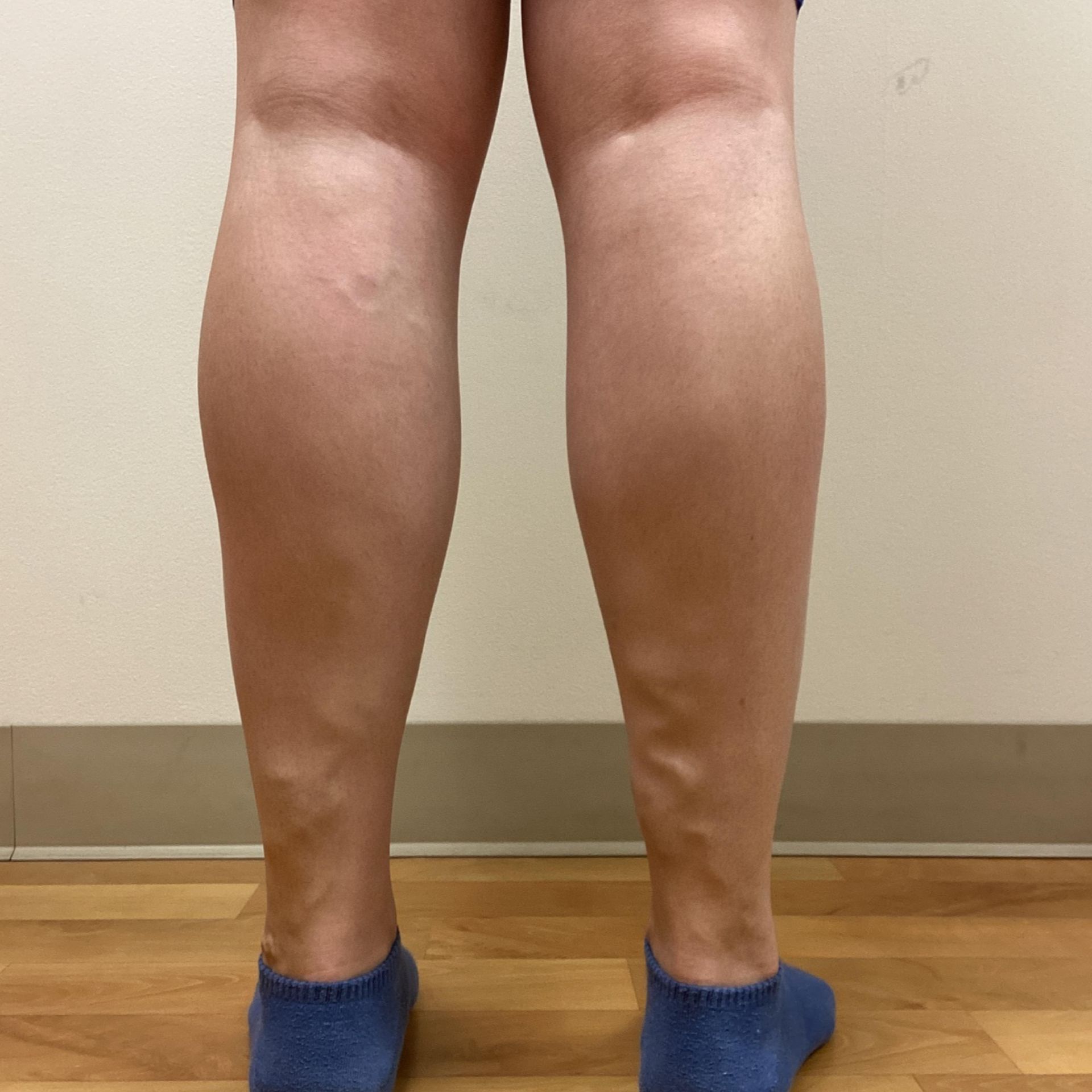 Alaska Vein Care | Alaska's Premier Varicose Vein Specialists