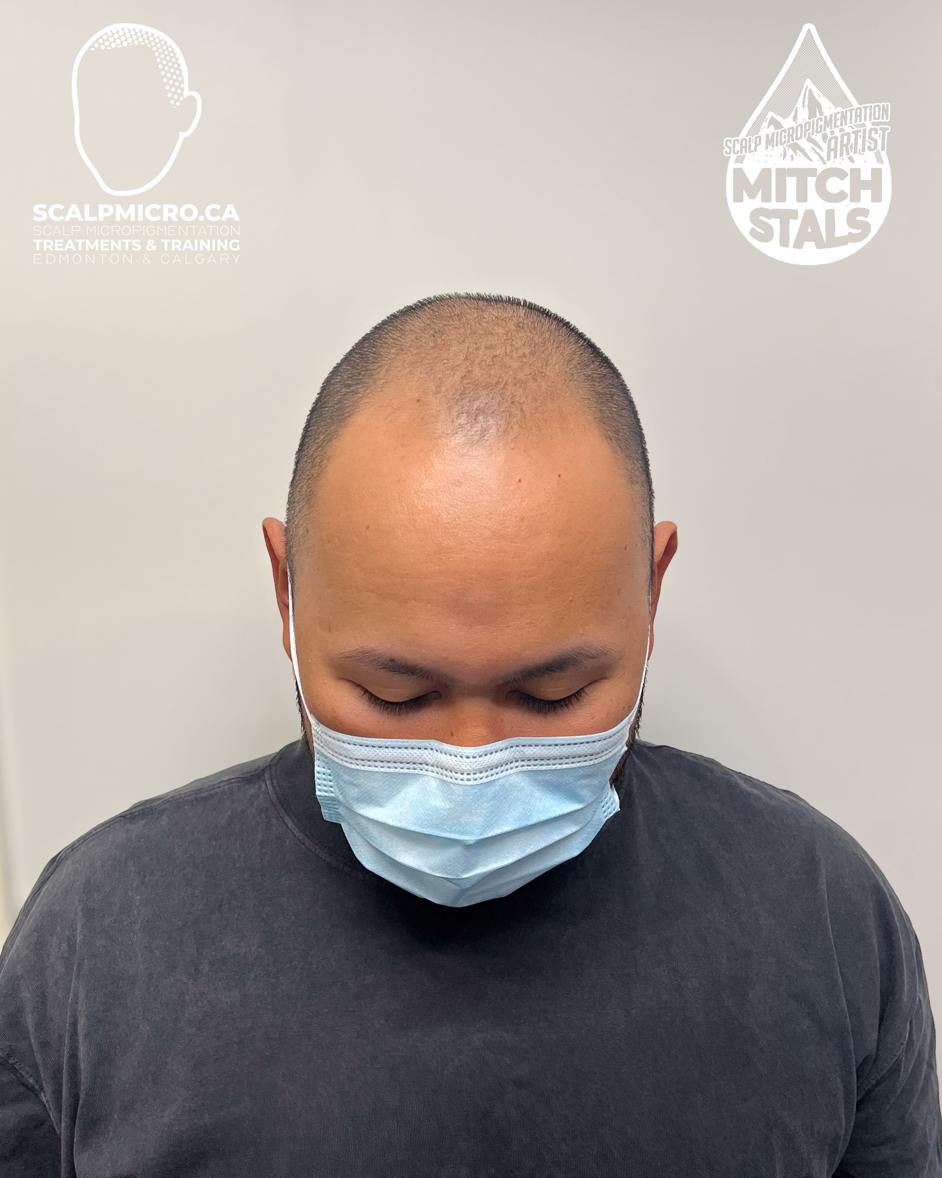 Before & After Photos | SMP Edmonton