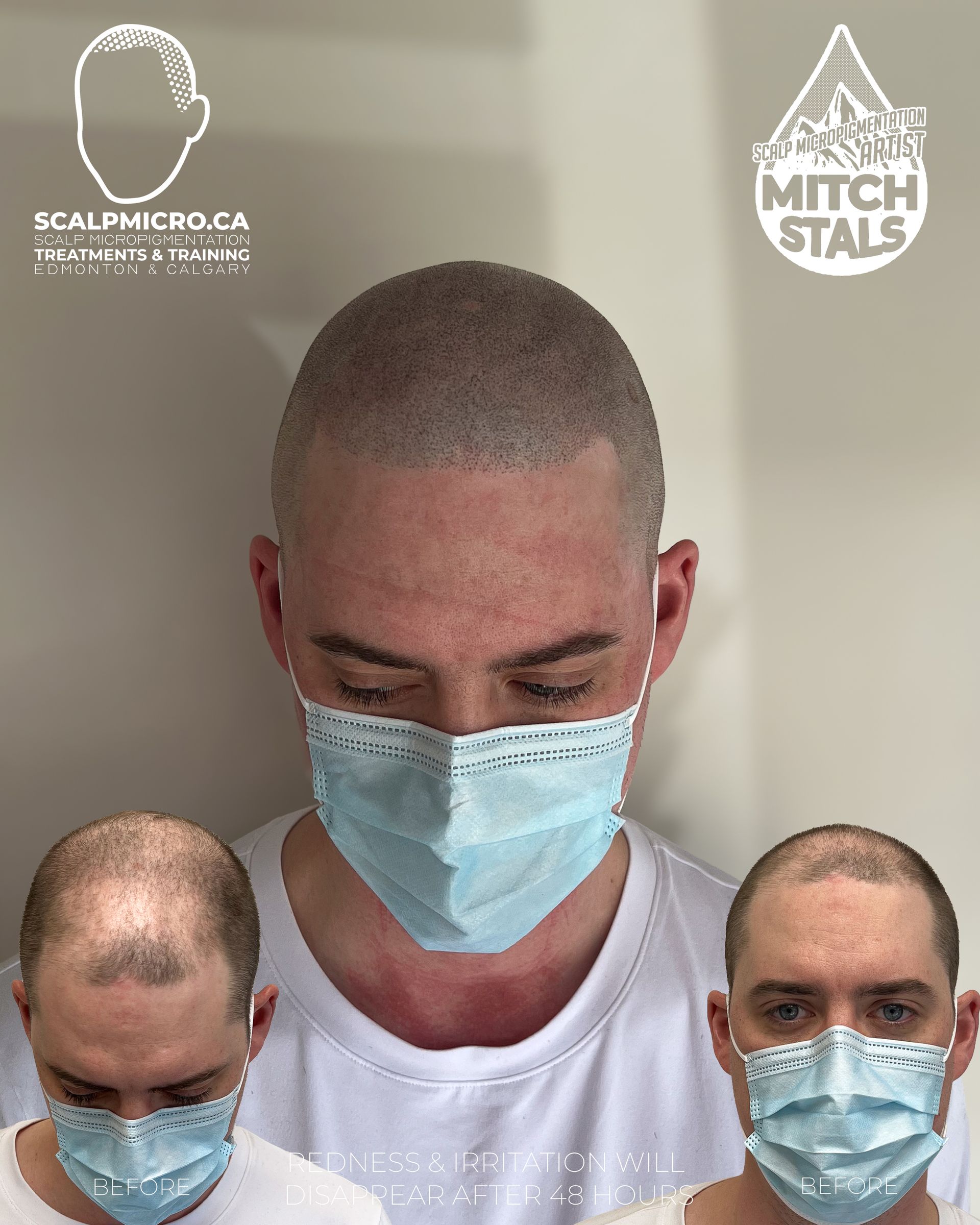 Client Profiles | SMP Edmonton | Edmonton Alberta