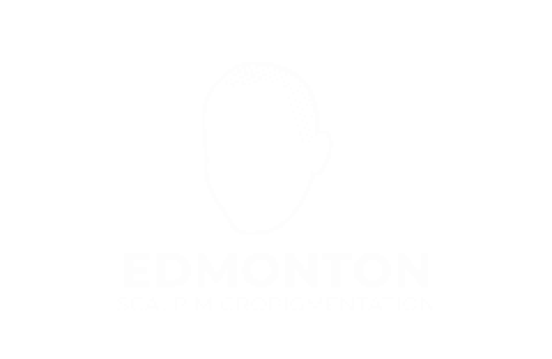 Scalp Micro Pigmentation Edmonton SMP - Bye Bye Bald and Thinning Hair