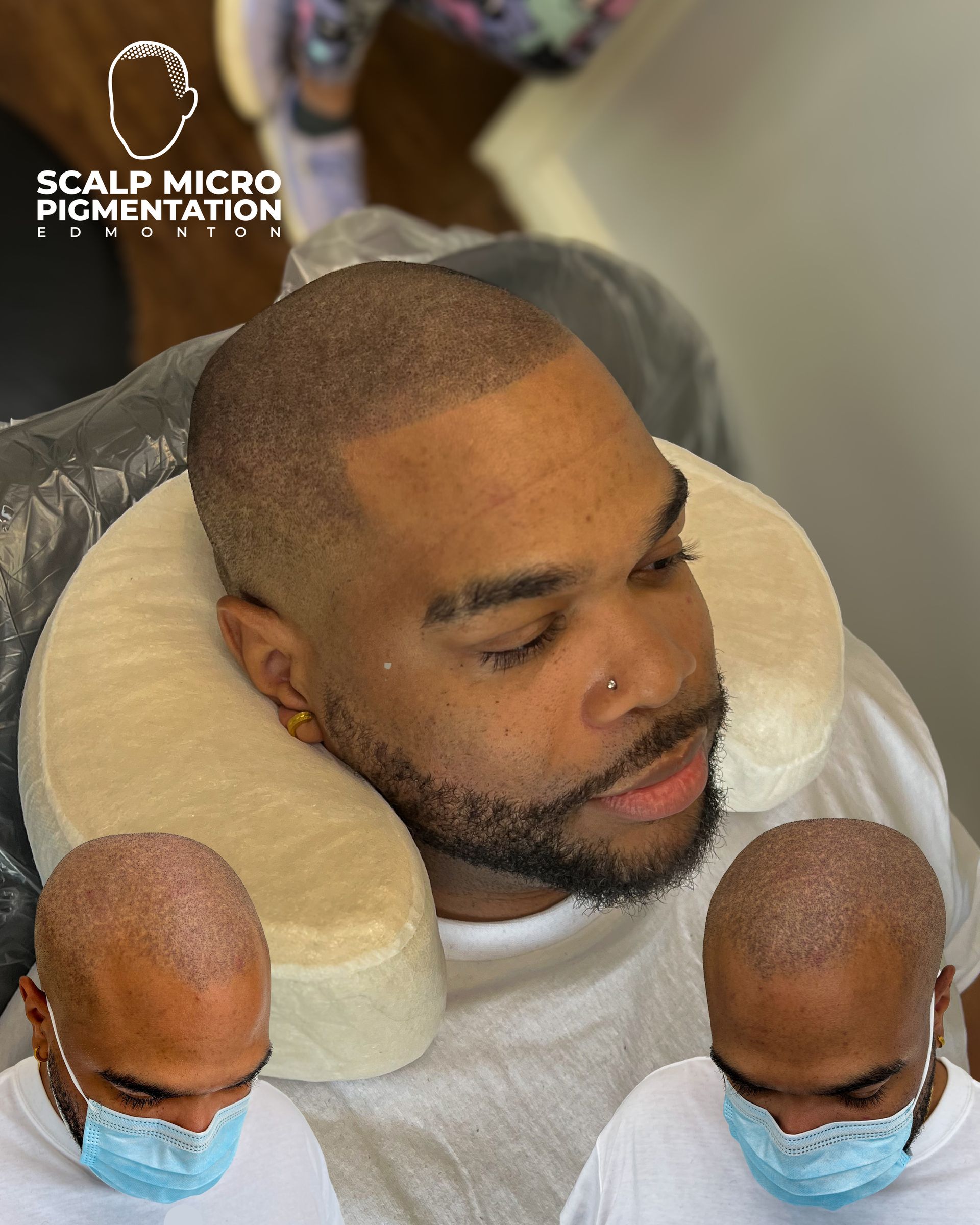 Before & After Photos | SMP Edmonton