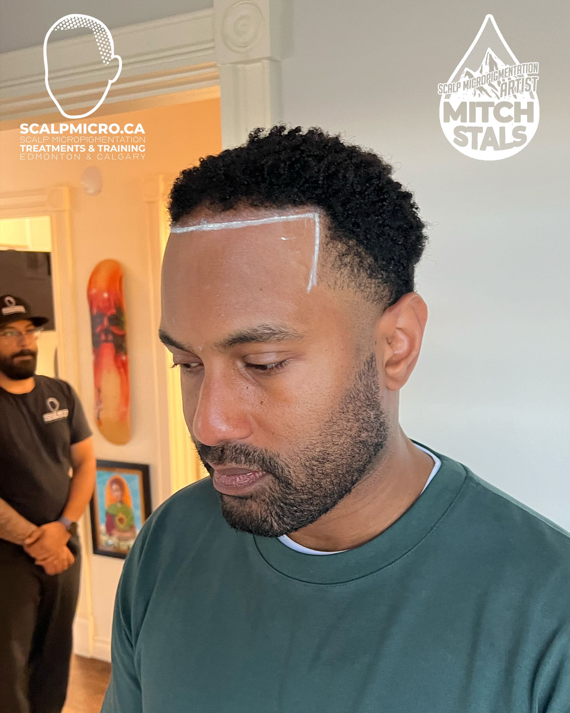 Before & After Photos | SMP Edmonton