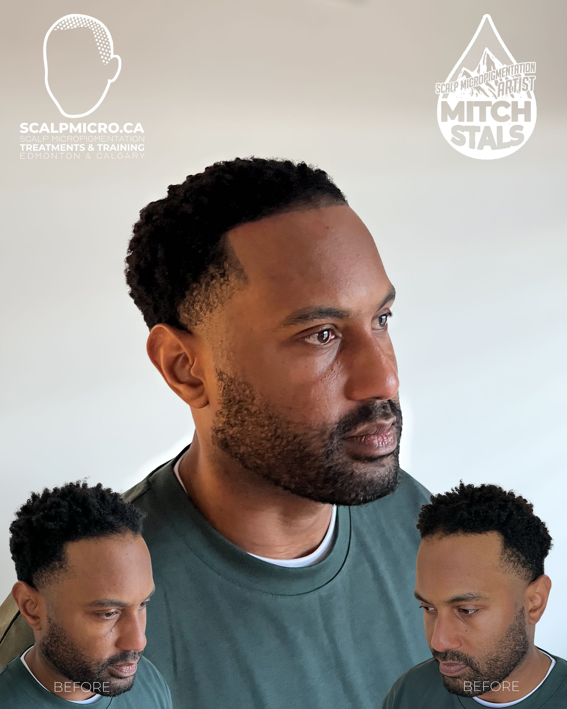 Before & After Photos | SMP Edmonton